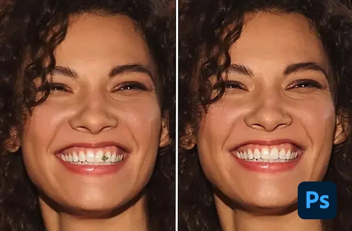 Blemish Remove: Fix & Remove Blemishes From Photo - Adobe Photoshop